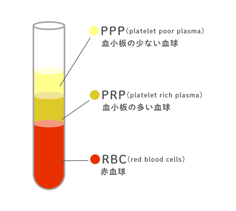 PRP-FD再生療法｜南越谷駅徒歩1分の皮膚科・美容皮膚科｜咲皮ふ科クリニック